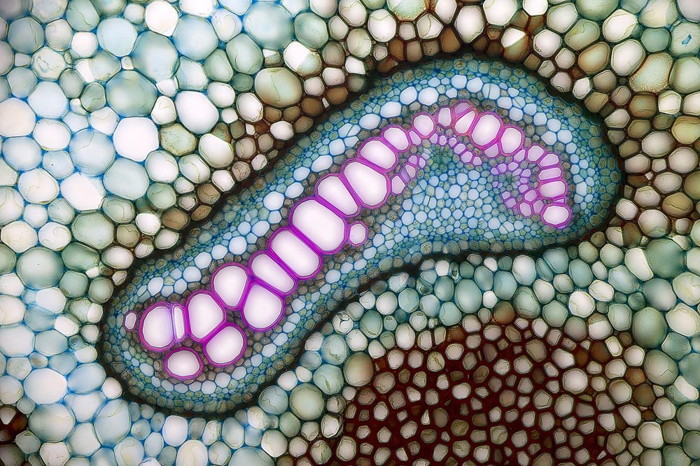 Vascular, Vascular Bundle, Vein